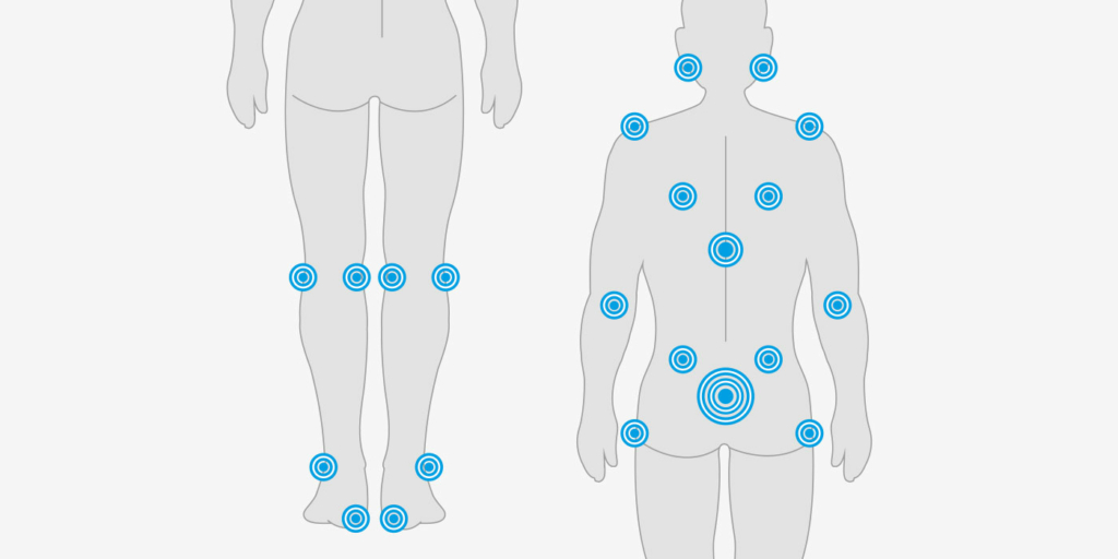 EXPERTENSTANDARD DEKUBITUS - PROEXPERT